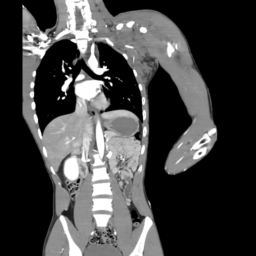 CT Case 086 • LITFL • CT scan interpretation