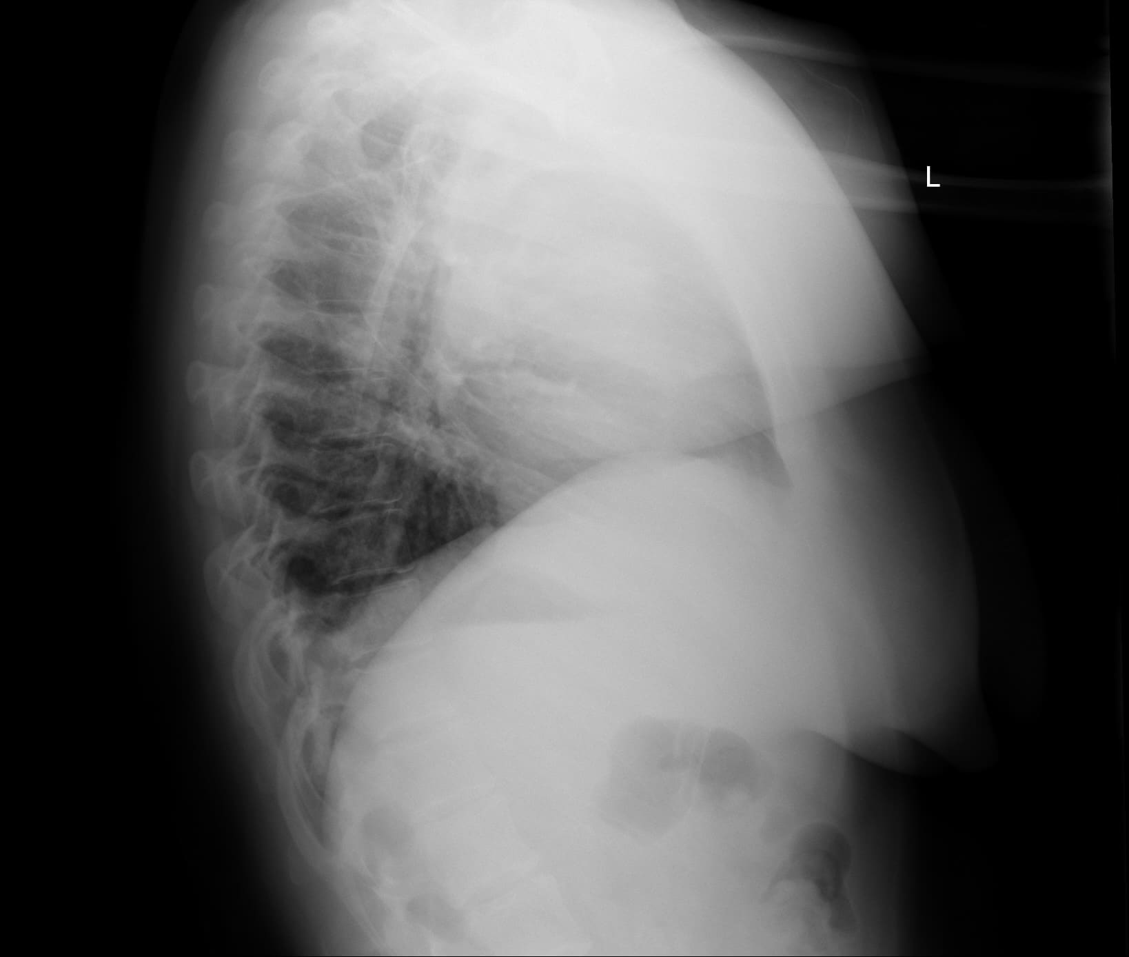 CT Case 087 • LITFL • CT scan interpretation