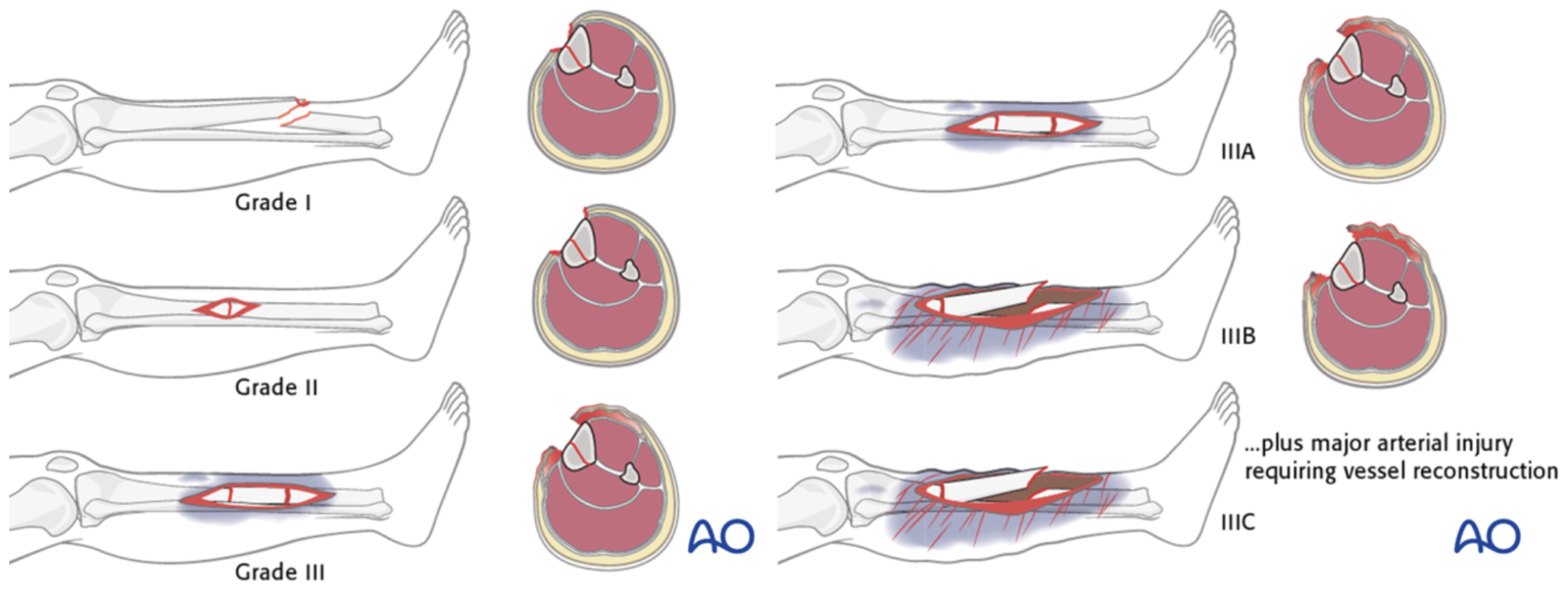 Funtabulously Frivolous Friday Five 362 • LITFL • FFFF