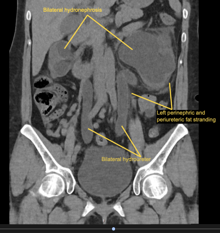 CT Case 101 • LITFL • CT scan interpretation