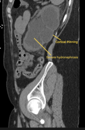 CT Case 101 • LITFL • CT scan interpretation