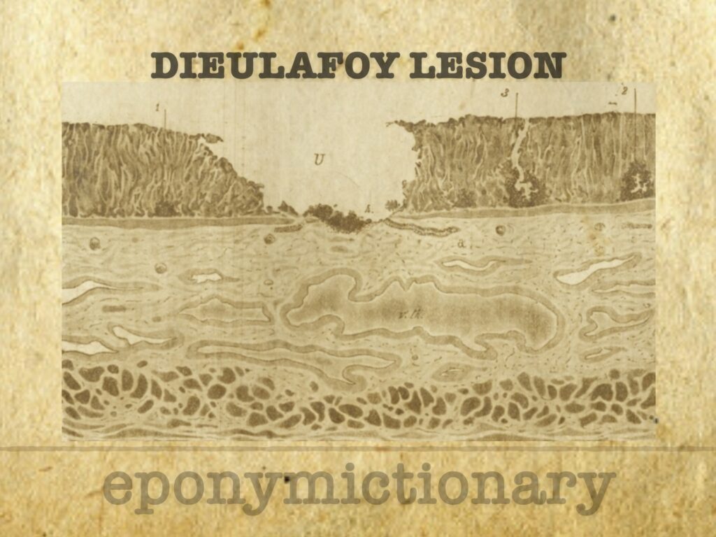 Georges Dieulafoy Archives • LITFL