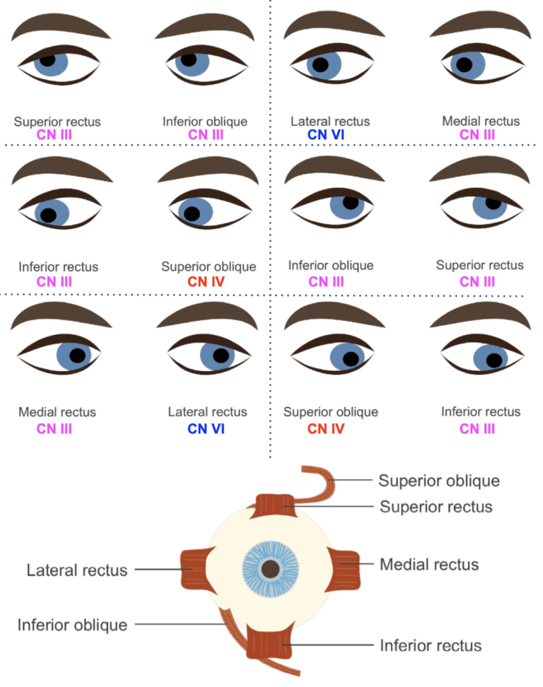 Sixth Cranial Nerve Lesions • LITFL • FFS