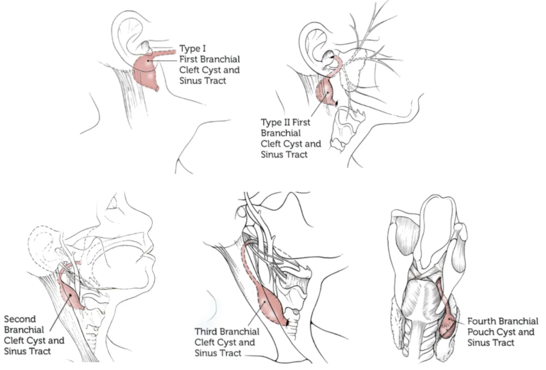 CT Case 095 • LITFL • CT scan interpretation
