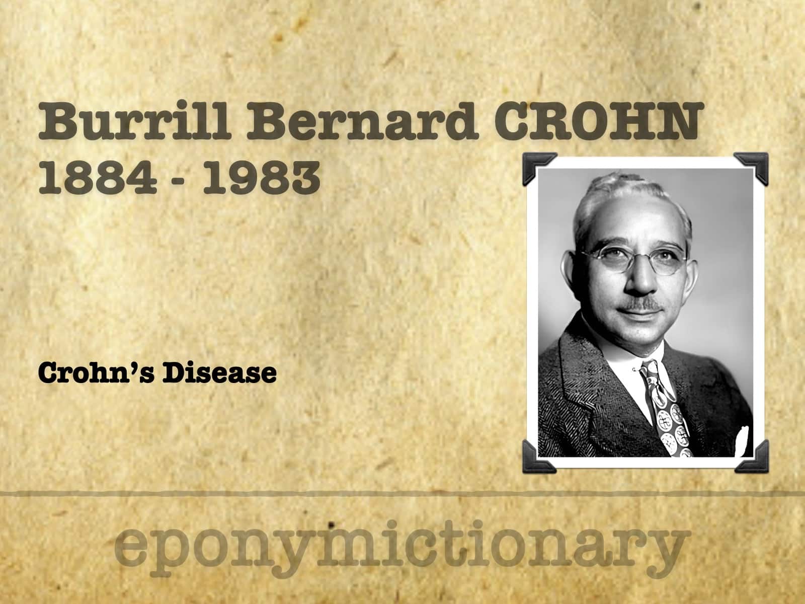 Crohn disease Archives • LITFL
