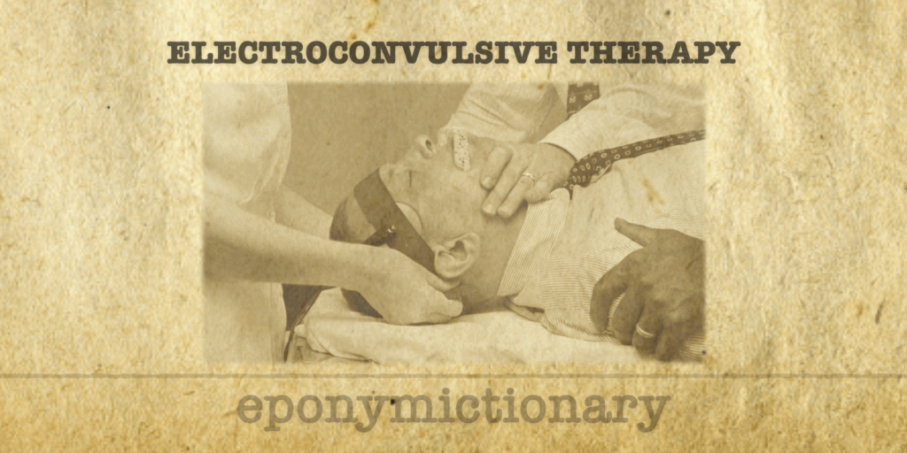 History of Electroconvulsive Therapy (ECT) • LITFL • Eponymictionary