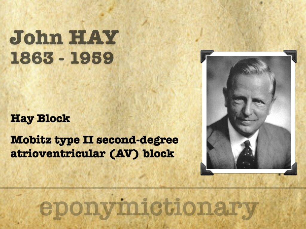 Hay AV block Archives • LITFL