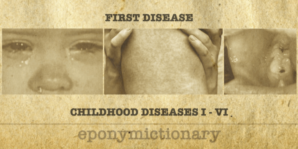 First disease • LITFL • Medical Eponym Library
