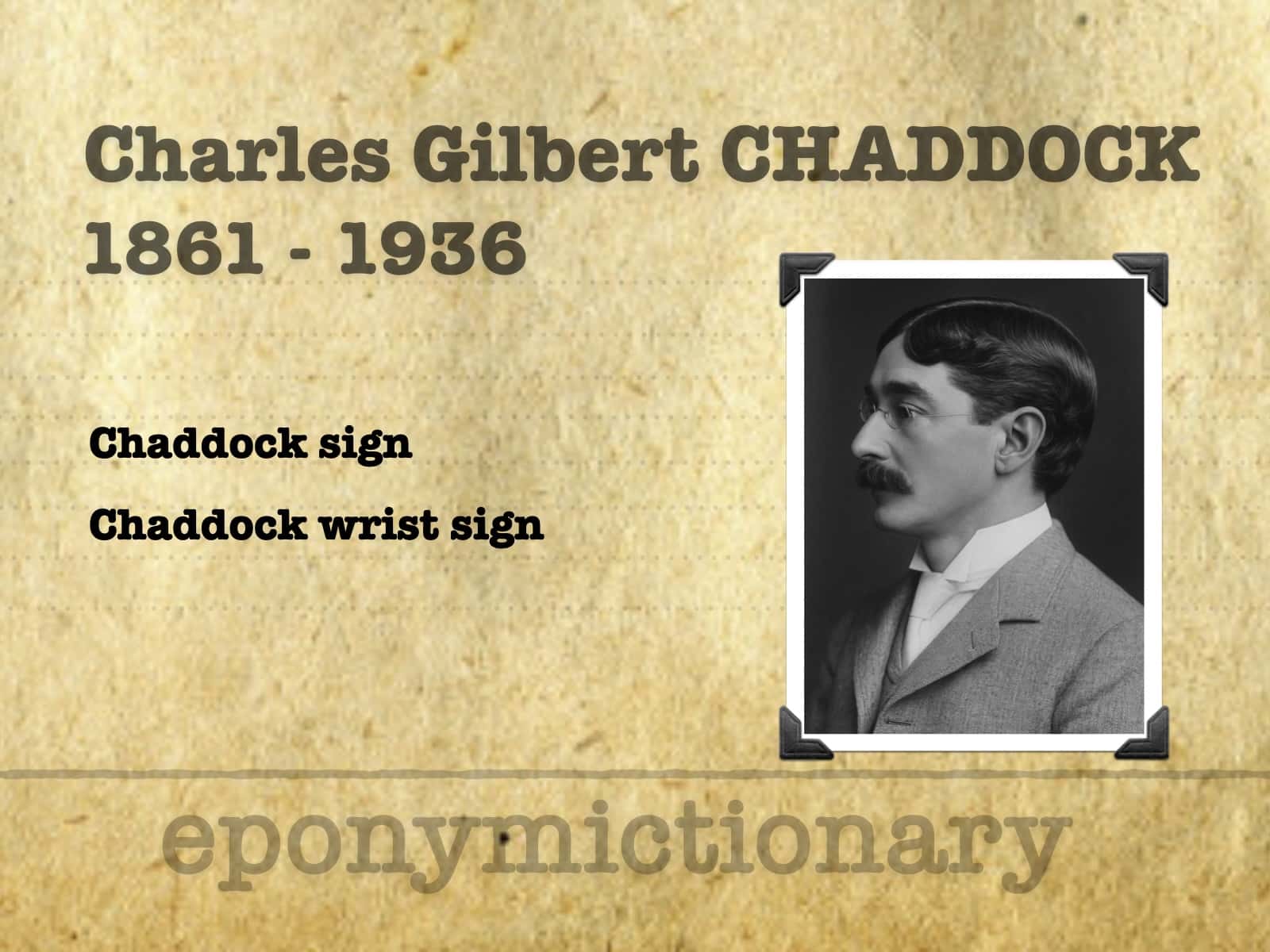 Charles Chaddock • LITFL • Medical Eponym Library