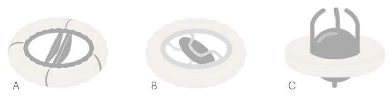 Echo basics: Prosthetic Valve • LITFL • Radiology Library