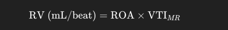 Echo basics: Mitral Regurgitation • LITFL • Radiology Library