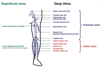 Superficial venous thrombosis • LITFL • Fellowship Notes