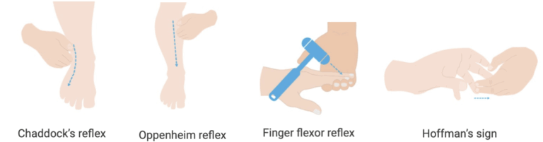 Neuro 101: Neurological Examination • LITFL • Neurology library