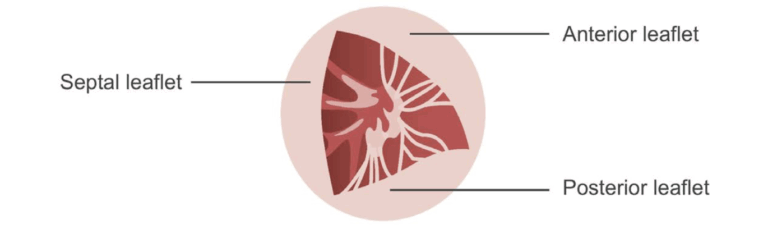 Echo basics: Tricuspid Valve • LITFL • Radiology Library