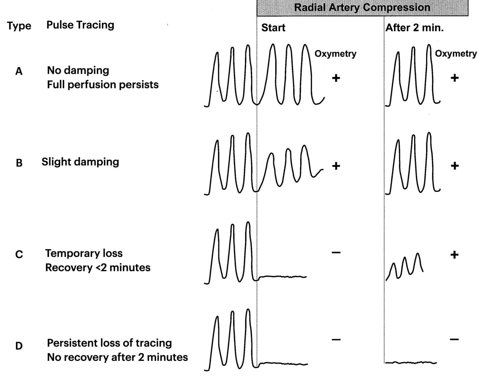 Allen test • LITFL • Medical Eponym Library