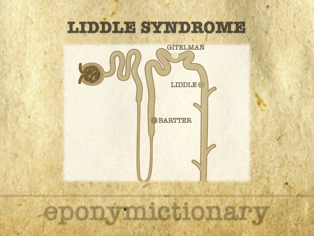 Liddle syndrome Archives • LITFL