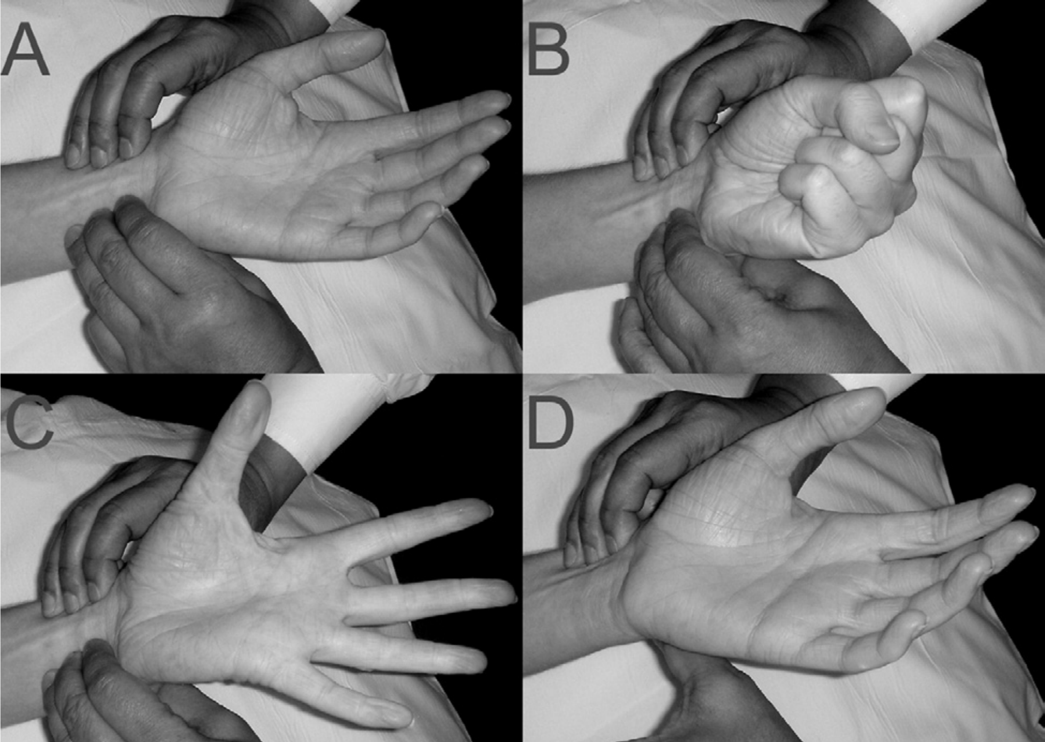 Allen test • LITFL • Medical Eponym Library