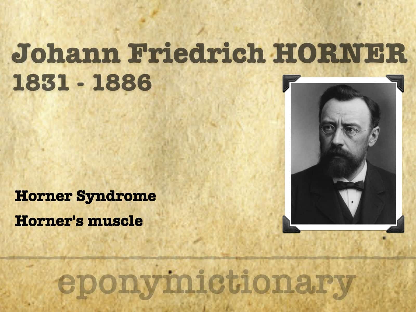 Horner's muscle Archives • LITFL