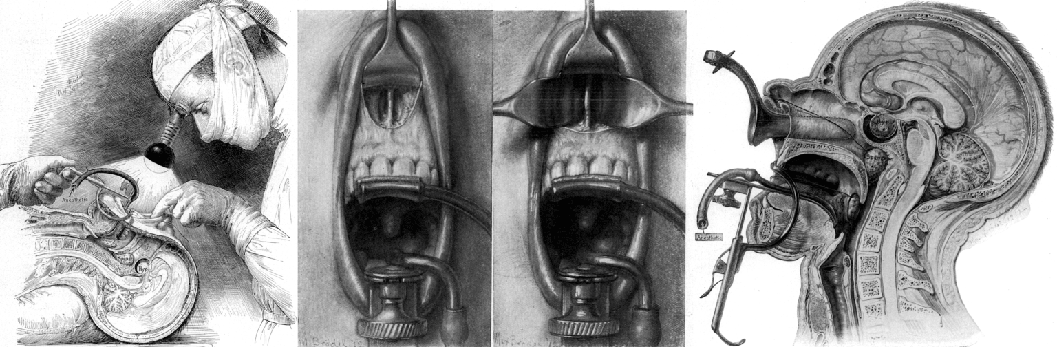 Max Brödel • LITFL • Medical Eponym Library