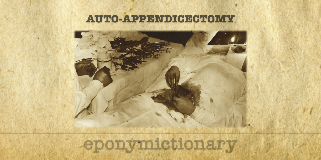 Auto-appendicectomy • LITFL • Eponymythology